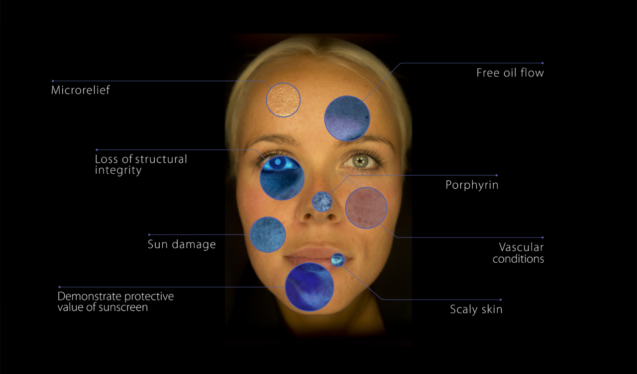 Skin analysis - Mana Skin Body & Soul